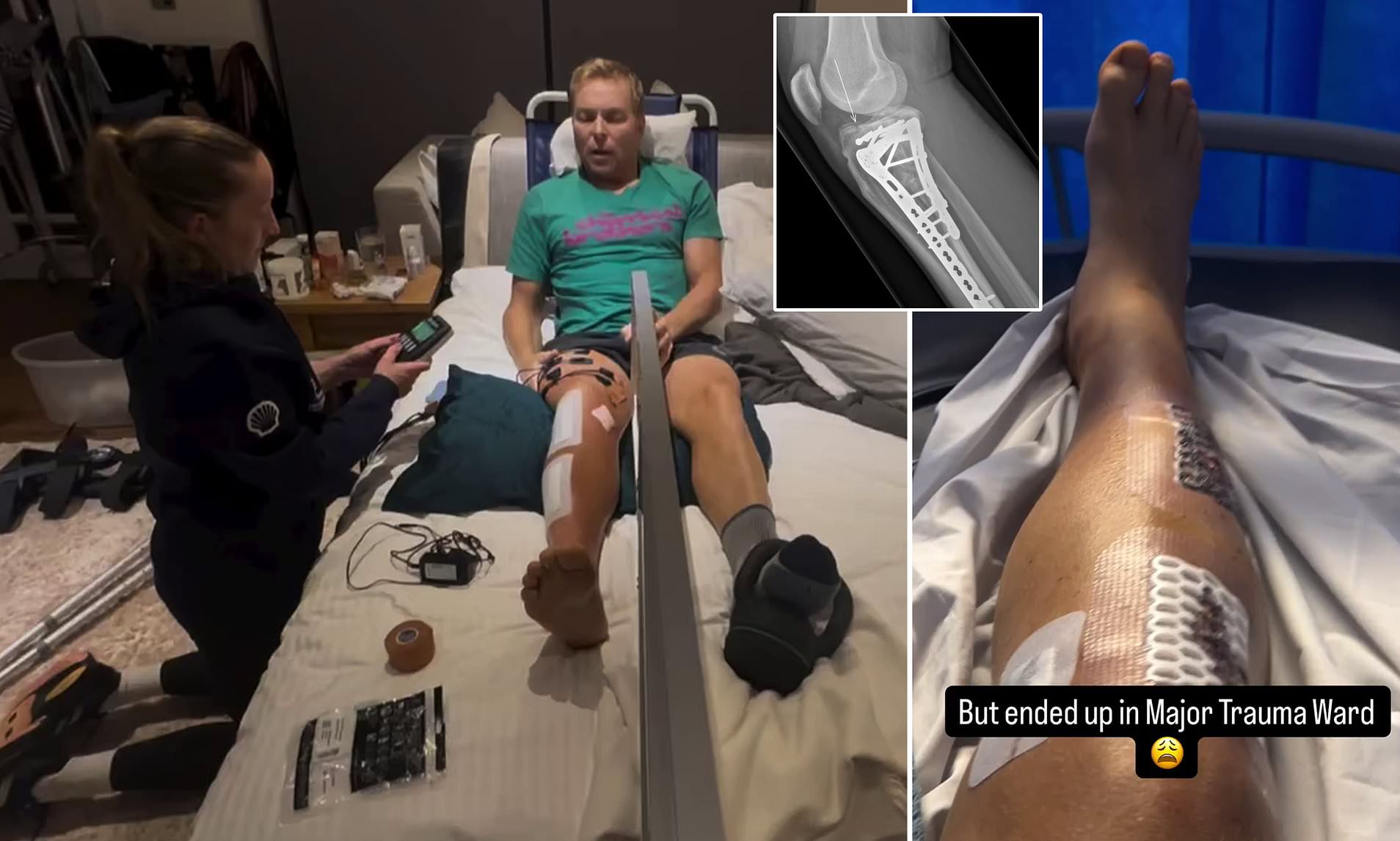 Sir Chris Hoy shares video of his 12-week recovery from broken leg in ...