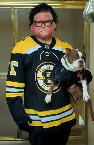 TikToker, 27, who had world's first face and hands transplant, recalls ...