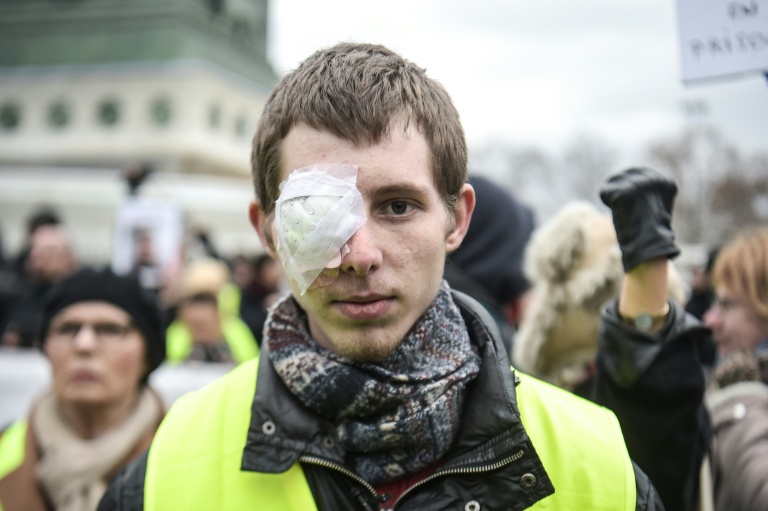 Franck Didron, gilet jaune éborgné : pas de policier identifié et non-lieu