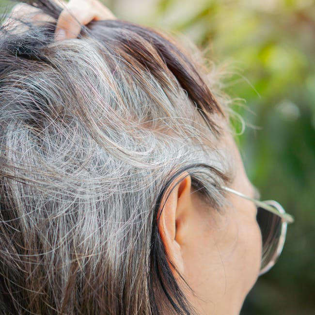 Derm reveals the one key nutrient deficiency behind premature gray hair ...