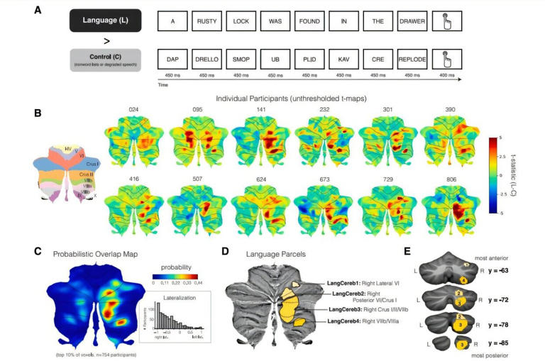 16 years of brain scans reveal the cerebellum's crucial role in human ...