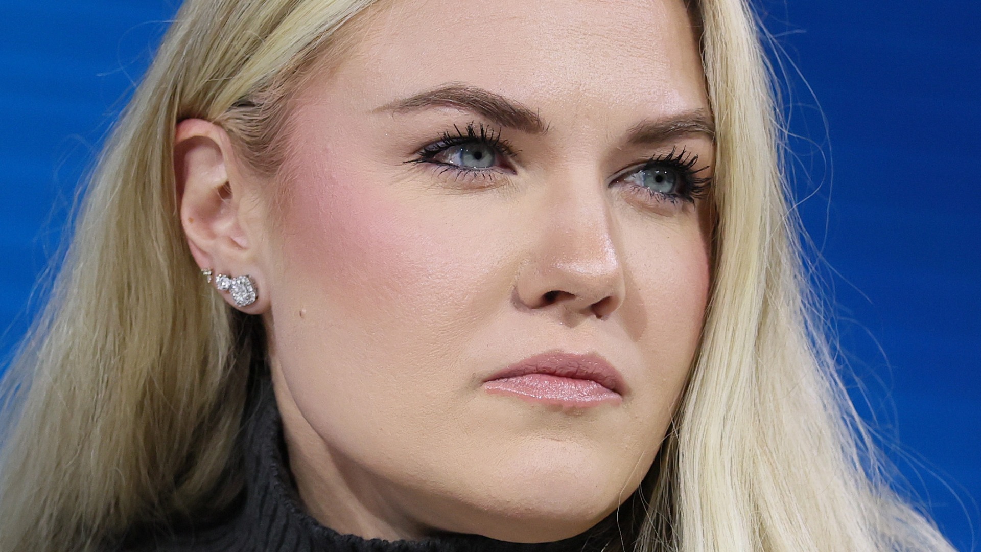 Everything Erika Kirk has done to her face, according to a plastic surgeon