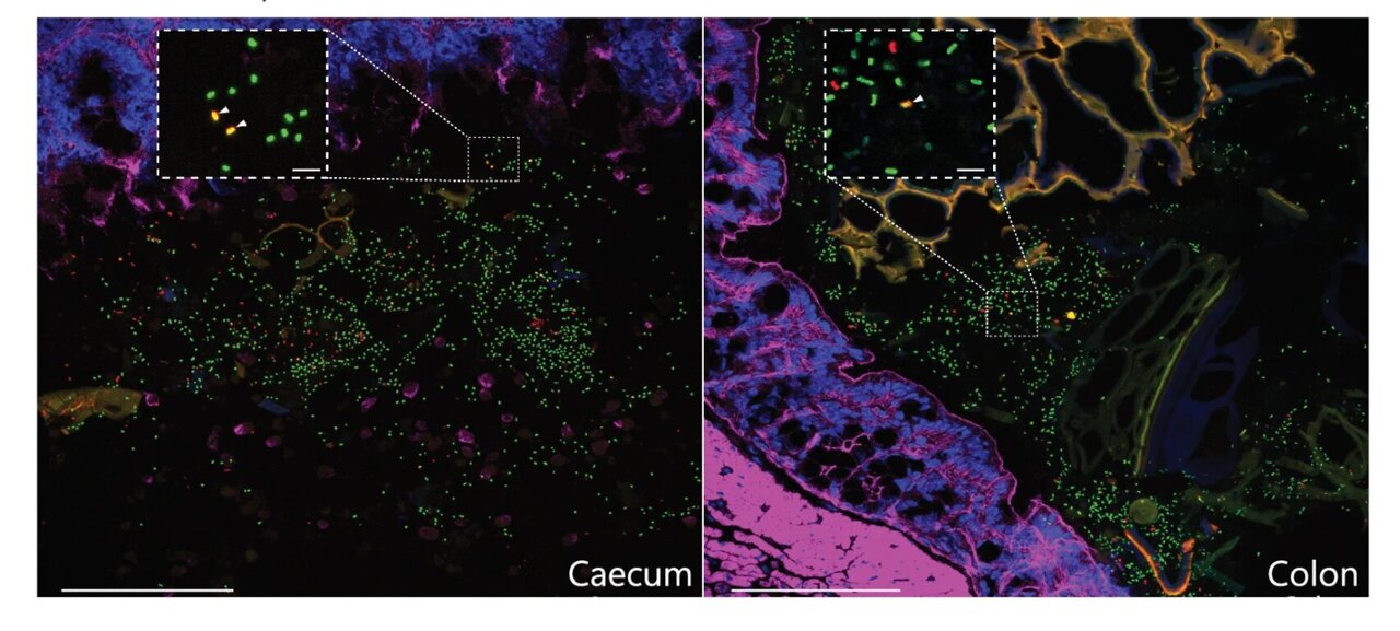 How gut bacteria share antibiotic resistance genes and fuel dangerous ...