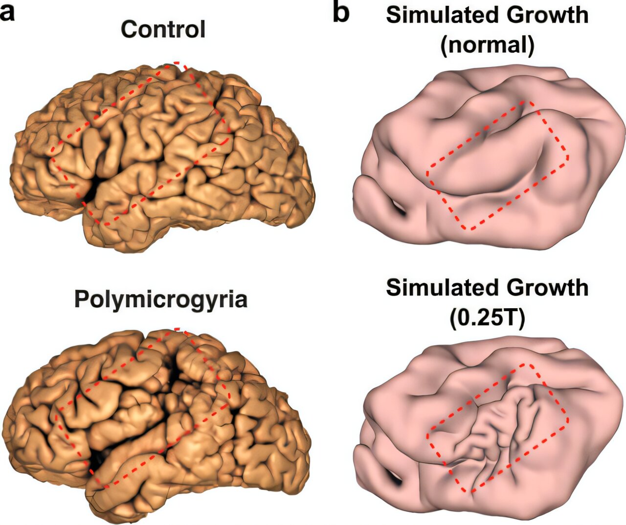 A curiosity-driven journey toward understanding brain folding