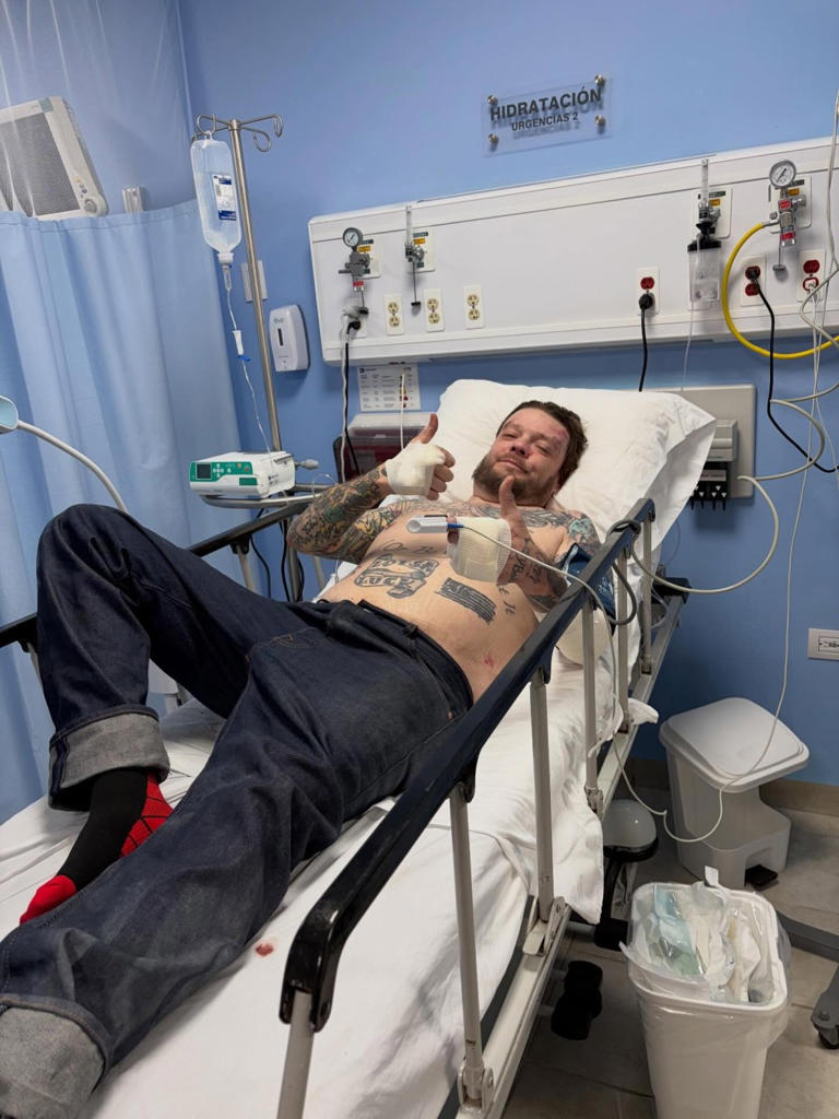 Corey Harrison of 'Pawn Stars' breaks 11 ribs in scary motorcycle crash