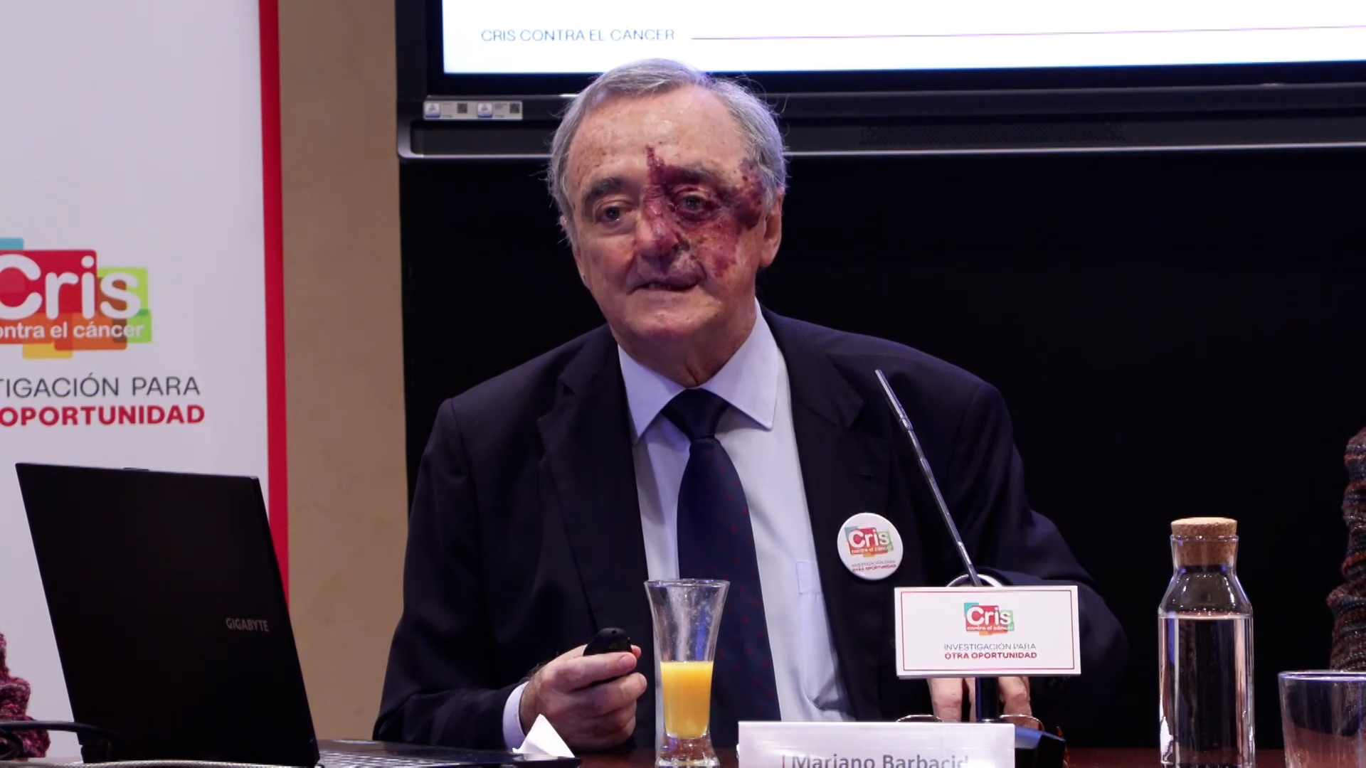 Logran eliminar por completo tumores de páncreas en ratones