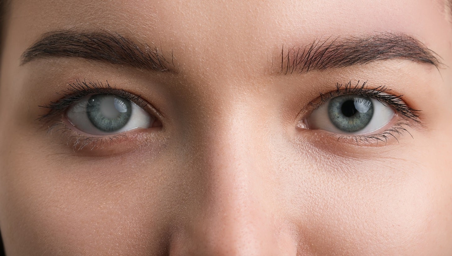 Myra Vision enrols first patient in trial of Calibreye glaucoma system