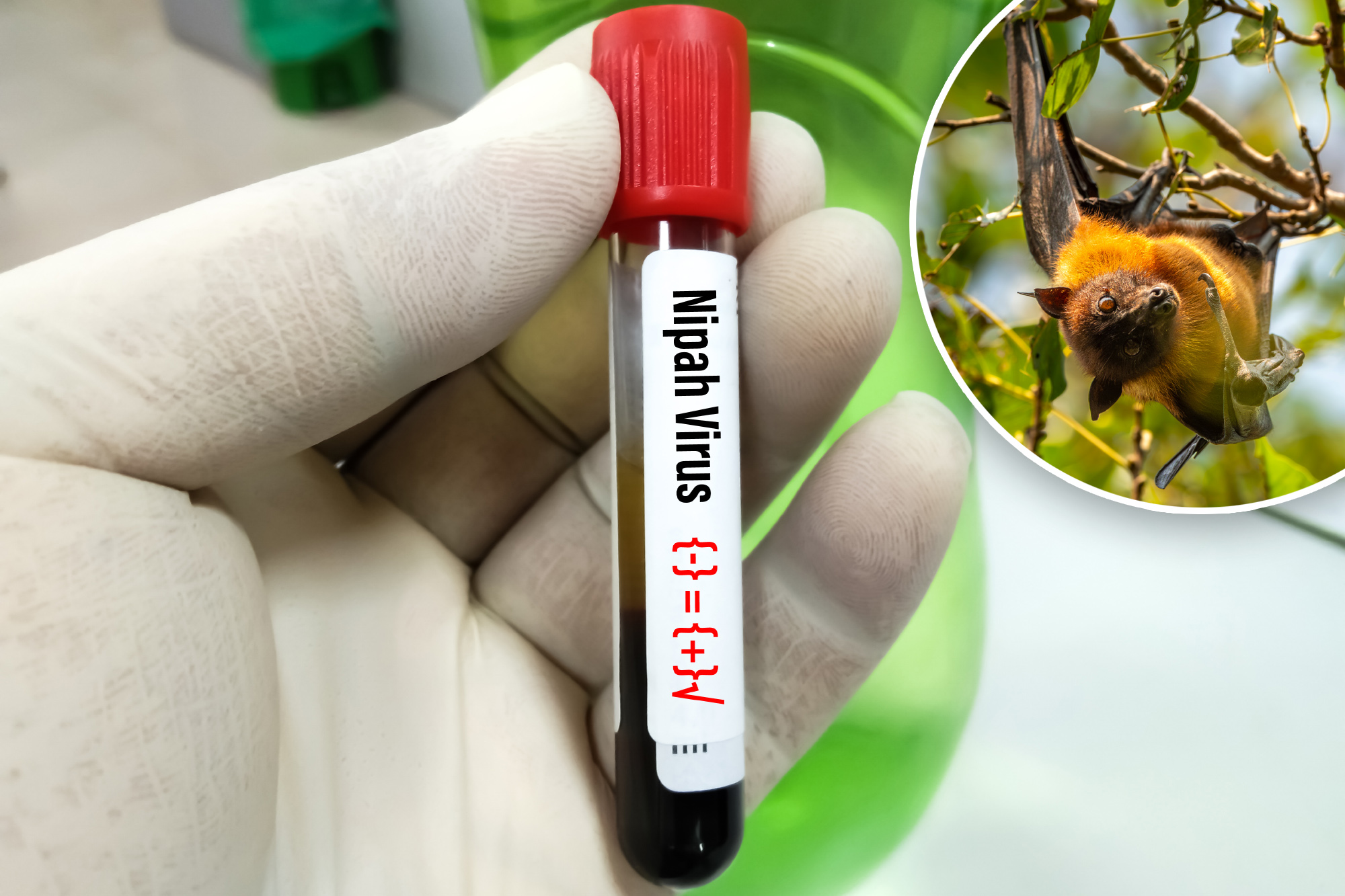 What is Nipah virus? Disease with ‘relatively high death rate’ found in ...