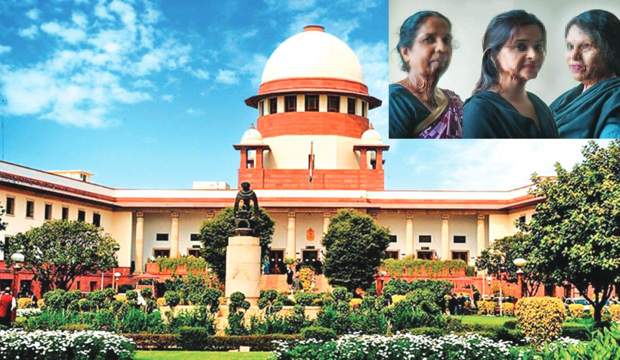SC takes strong note of acid attack cases