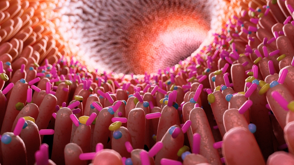 Gut inflammation link to Alzheimer's disease confirmed once again
