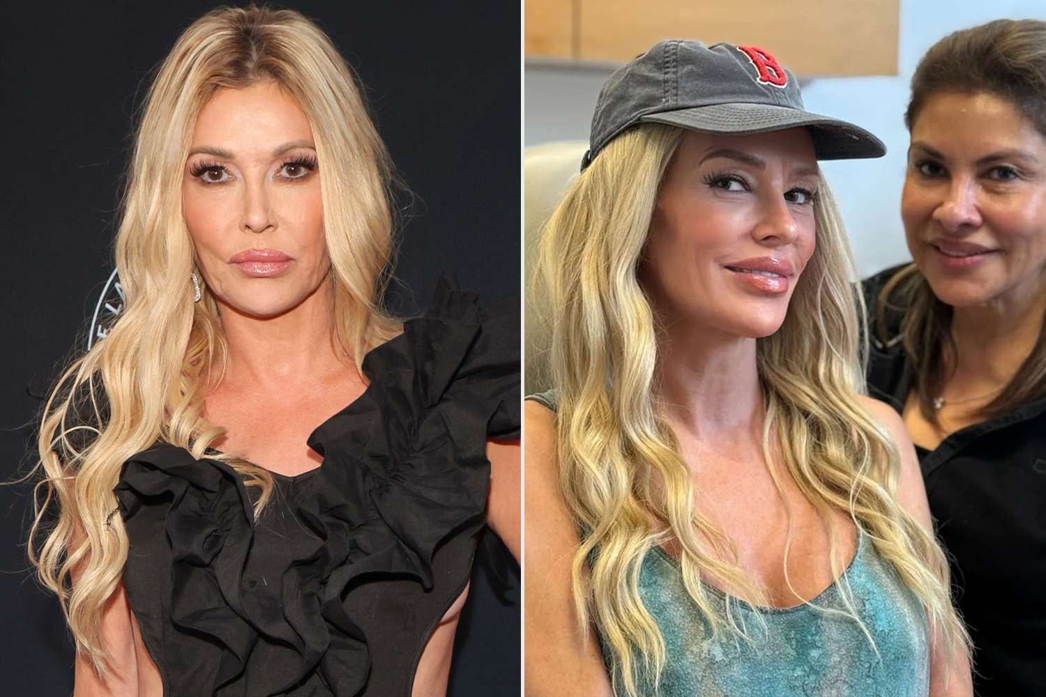 Brandi Glanville debuts new face amid struggle with 'parasite' that ...