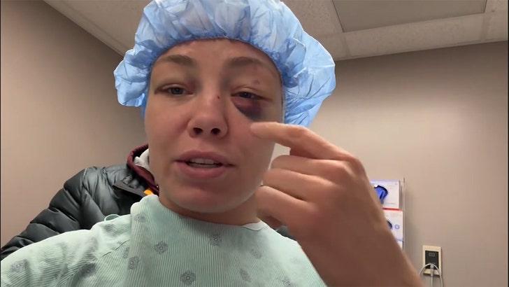 Rose Namajunas has eye surgery following UFC 324 loss