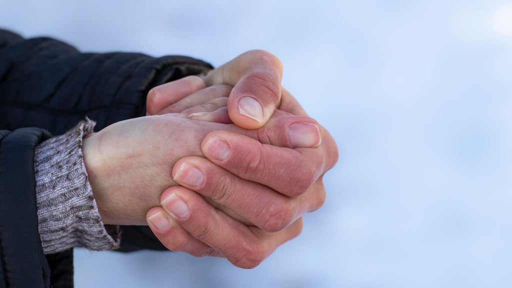 What is frostbite? A Pittsburgh-area doctor explains the injury.