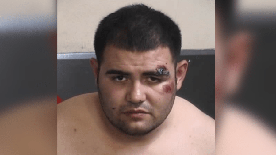 Coalinga man attacks girlfriend, medics after fight