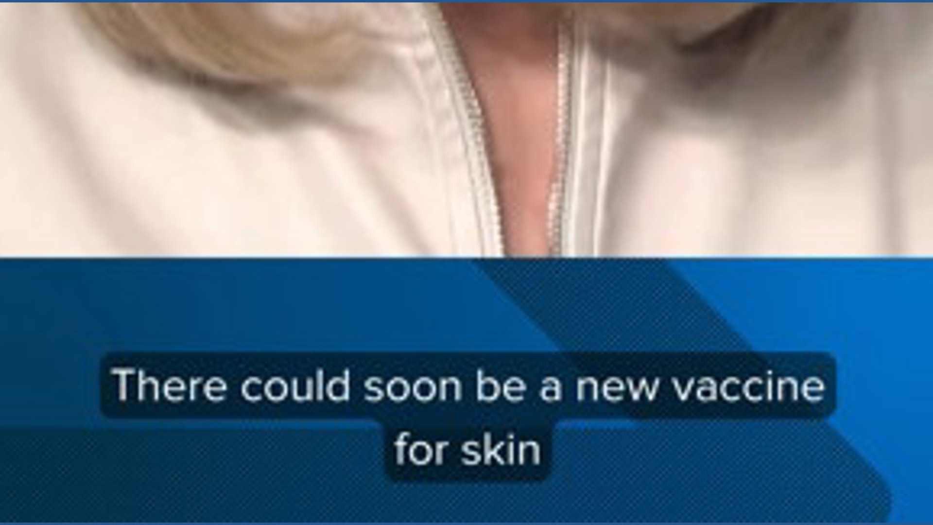 New melanoma vaccine shows promise in preventing skin cancer return