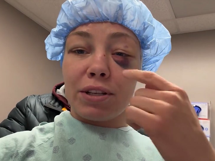 Rose Namajunas undergoes eye surgery after UFC 324 loss, gets tube inserted