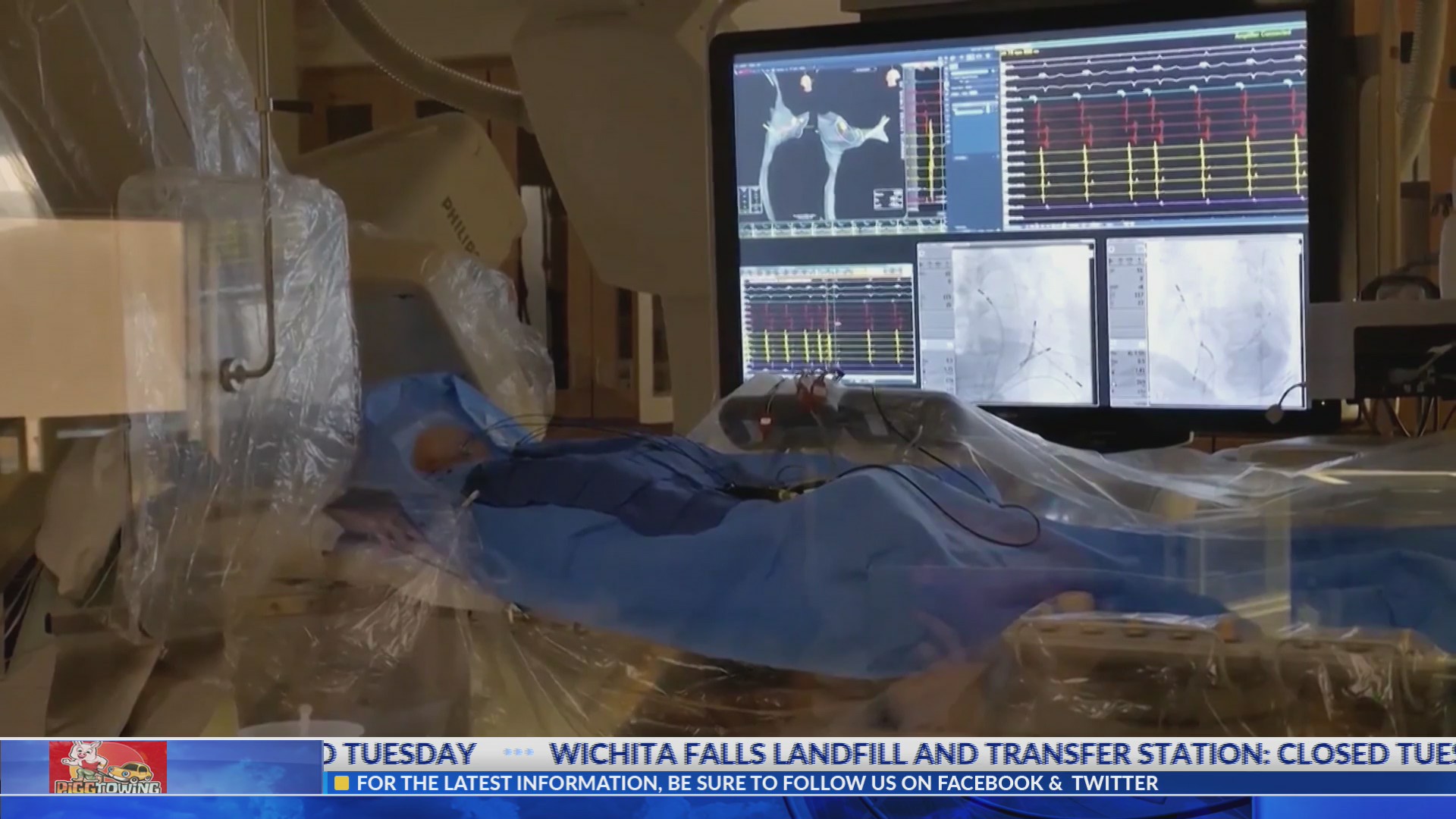 Healthy You: Upgrades to United Regional's Cath Lab brings hope to ...