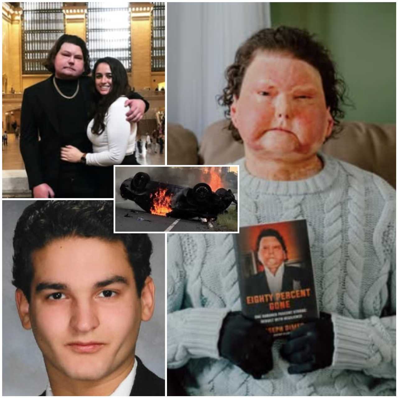 Burned alive: NJ man with new face tells his story