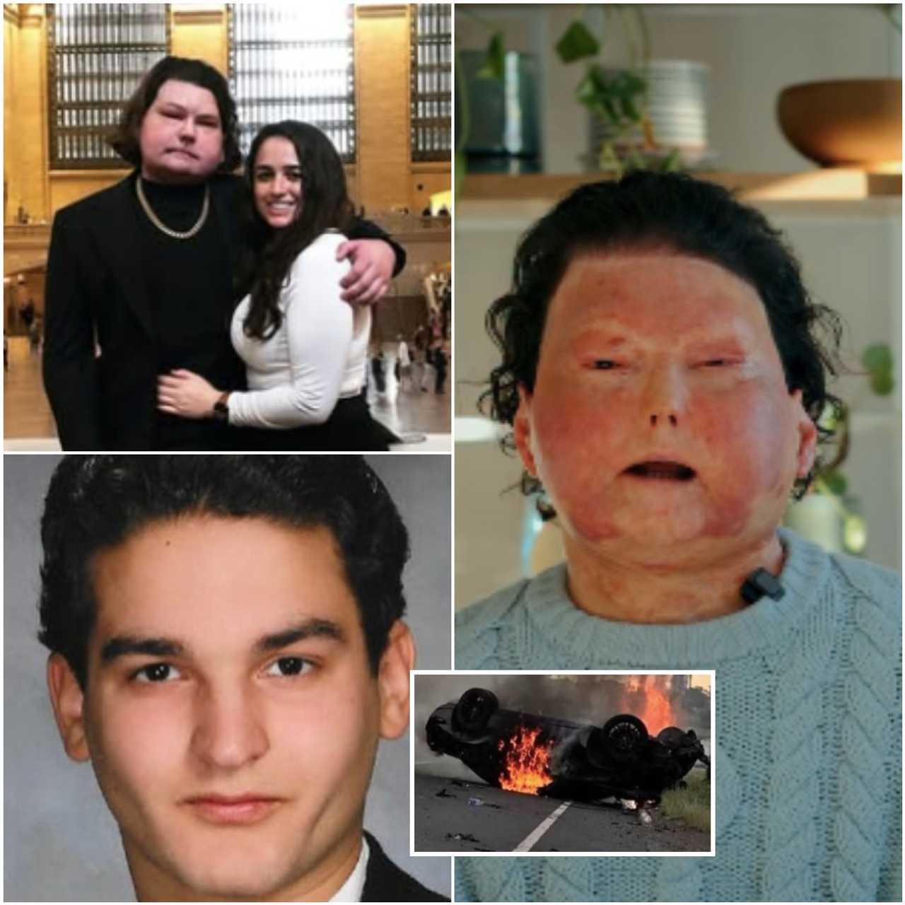 Burned alive: NJ man with new face tells his story