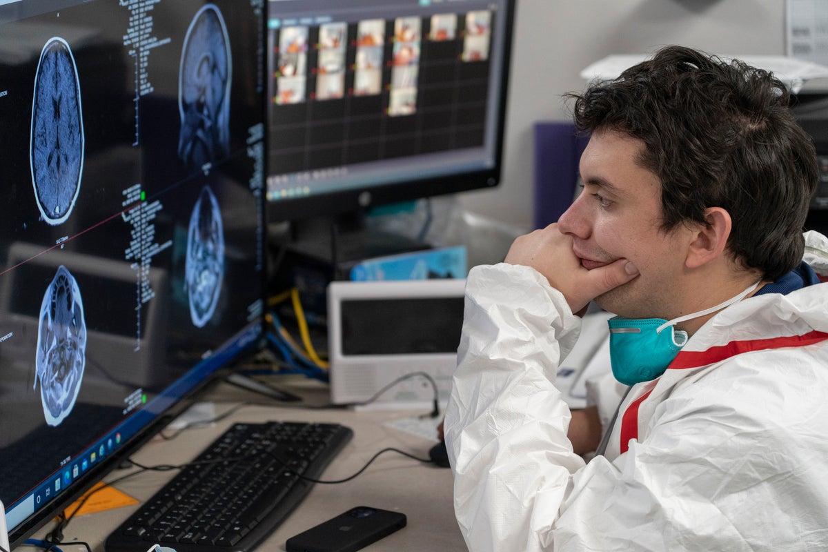 Advanced CTE quadruples risk for dementia, new study shows