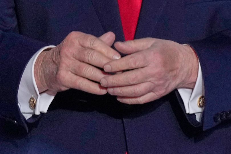 Trump pictured with bruised hand covered in makeup during Iowa speech