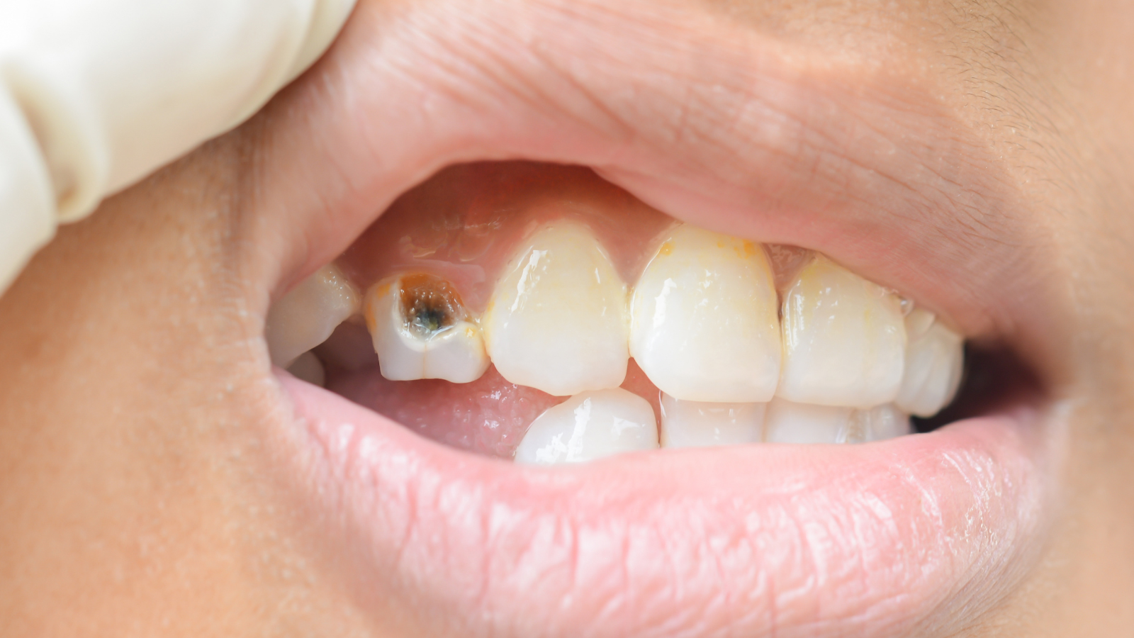 Why untreated dental issues matter