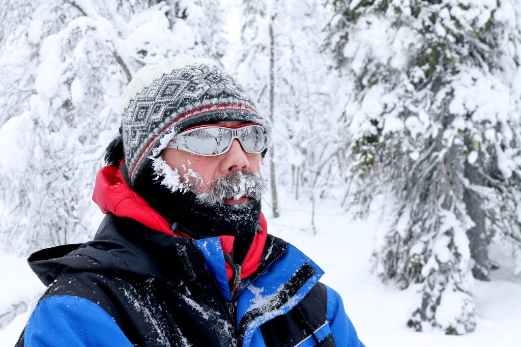 The 4 degrees of frostbite — and what to do to avoid a trip to the hospital