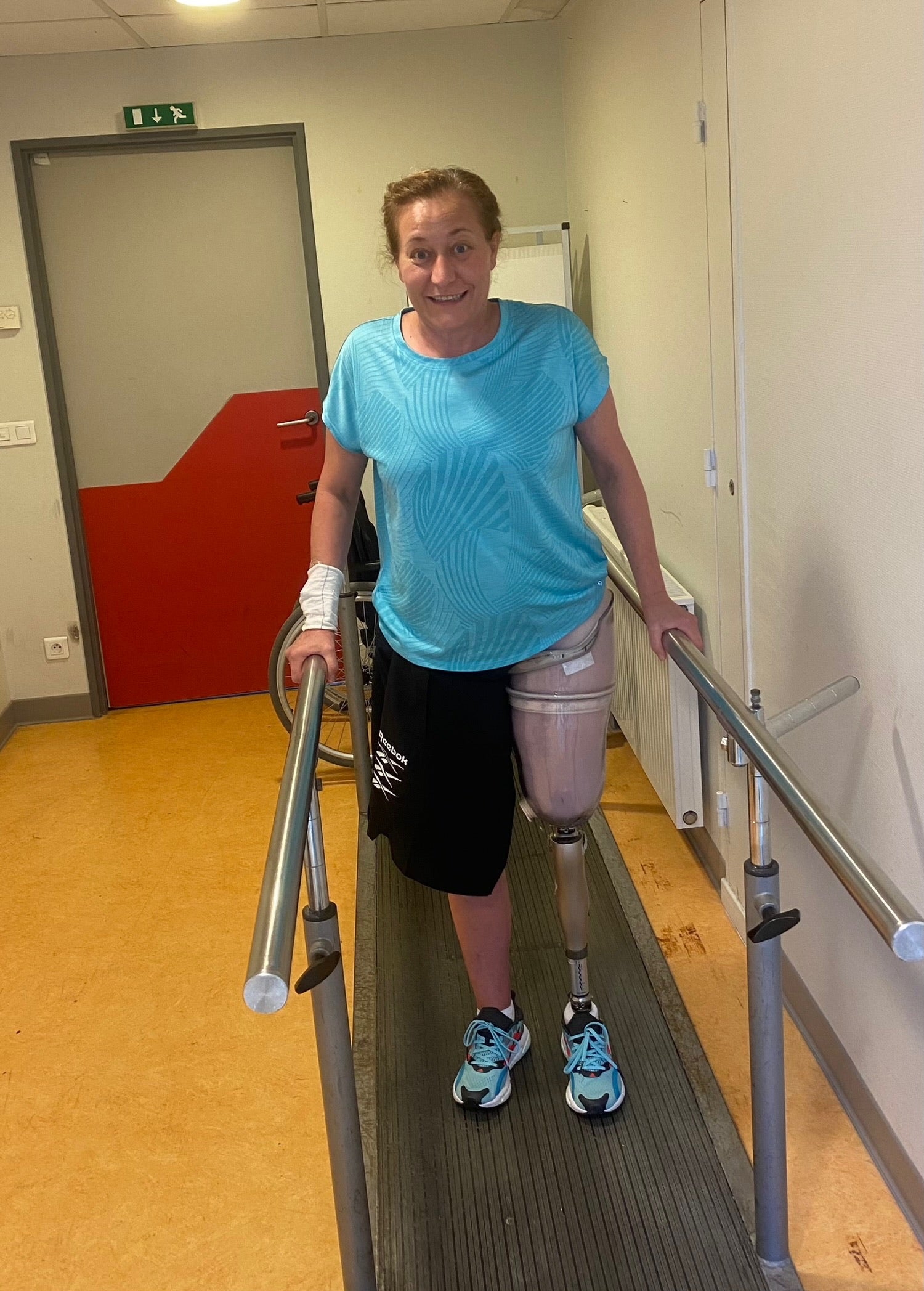 Mum lost leg to flesh-eating disease after thinking she had a cold