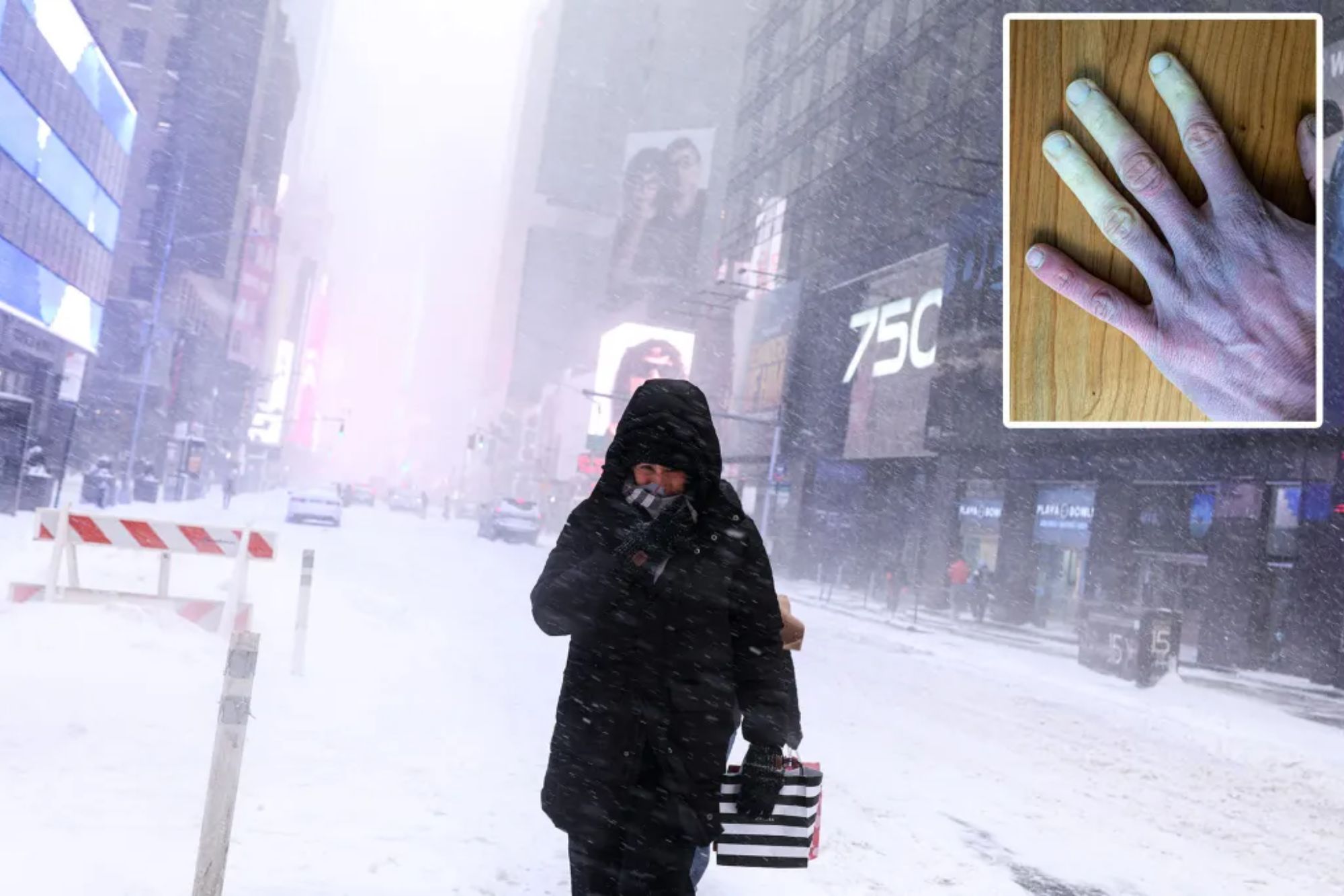 The 4 degrees of frostbite — and what to do to avoid a trip to the hospital