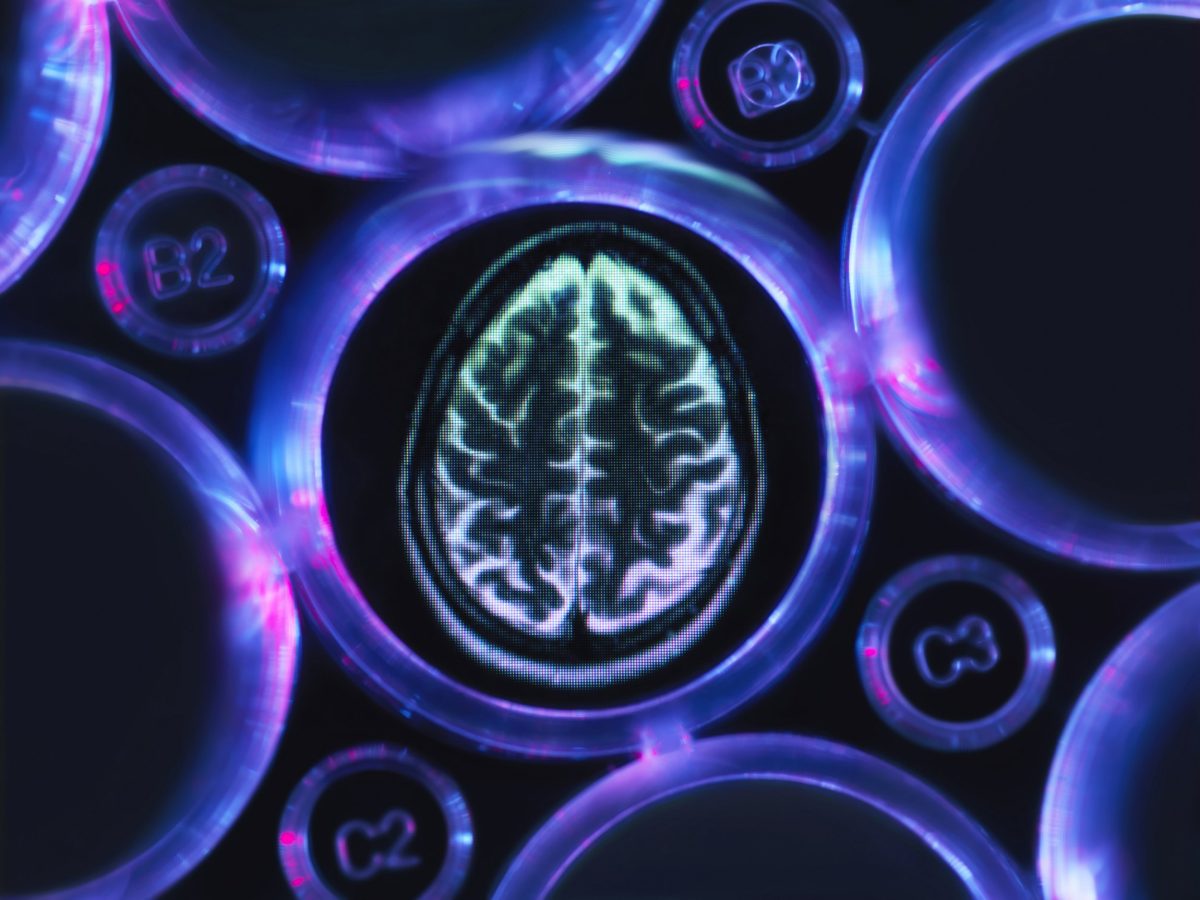 The symptoms of menopause that look like dementia, and what to do about ...