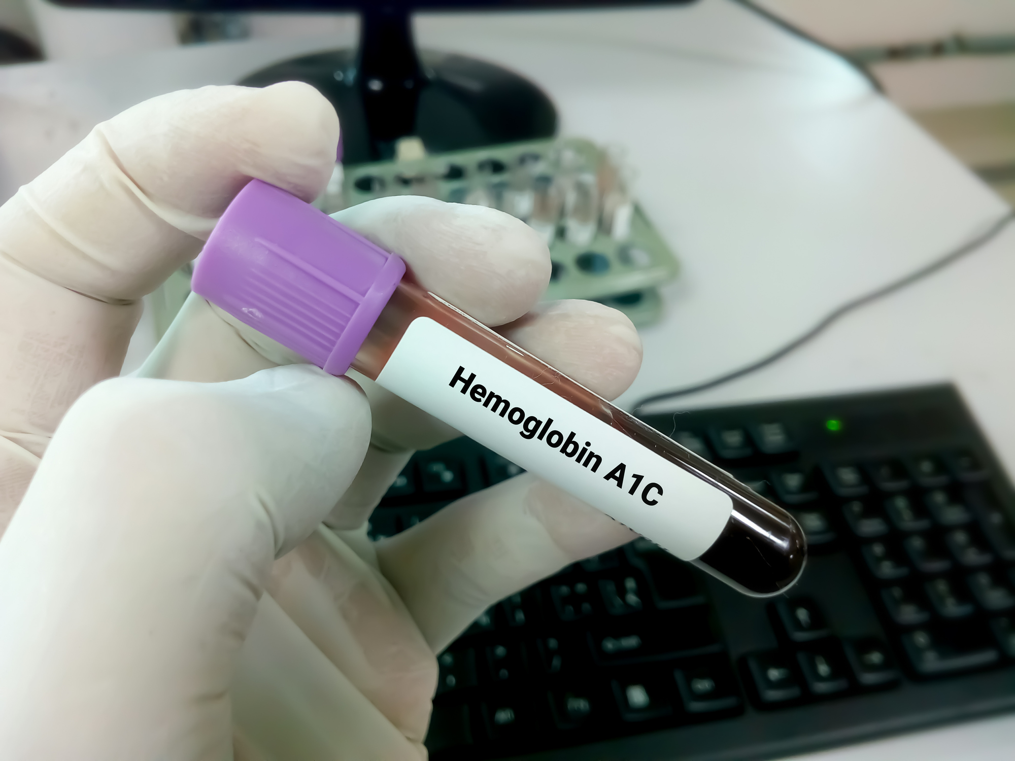 Blood work decoded: What boomers need to know