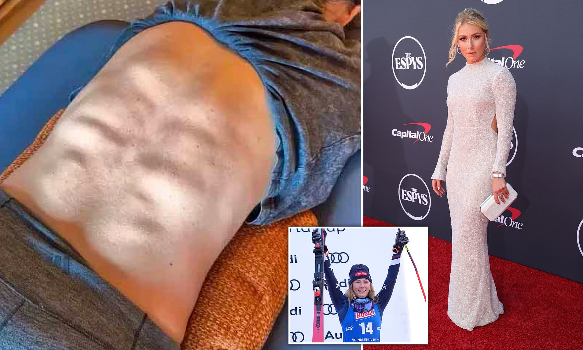 US Olympic star Mikaela Shiffrin shows off incredible six-pack on her back