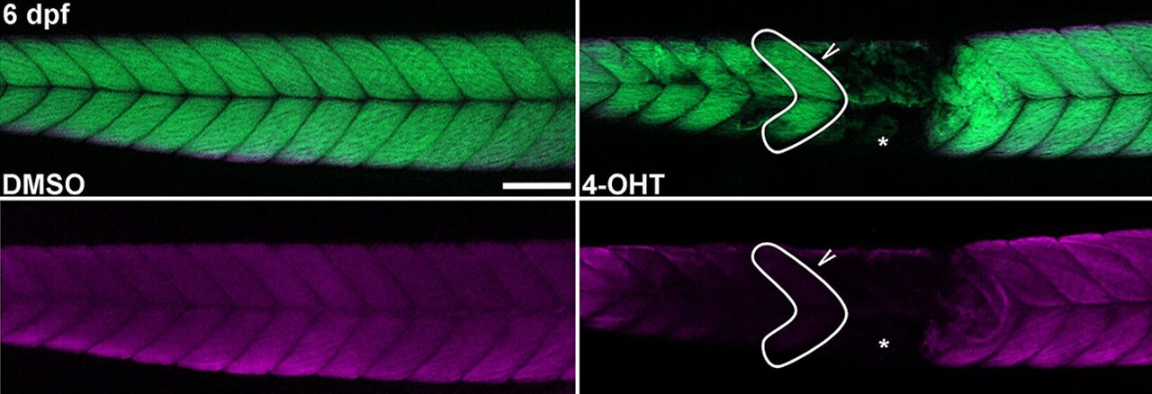 Modeling decades of muscle atrophy in weeks with new transgenic zebrafish
