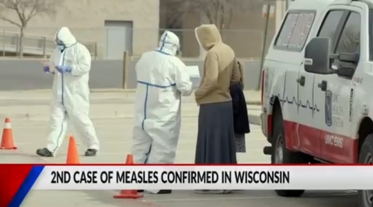 Second case of measles confirmed at UW Madison