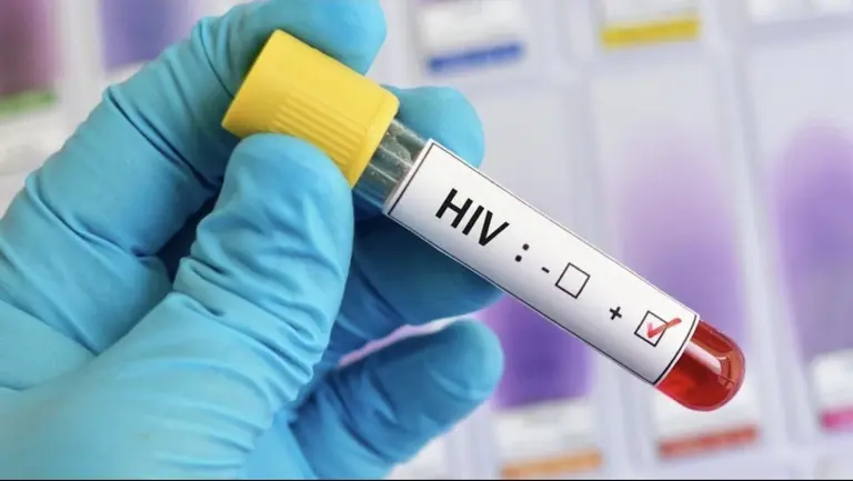 VIH au Cameroun : 21 000 nouvelles infections en 2025 malgré une baisse ...