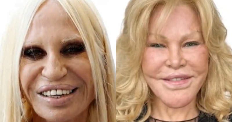 ‘This is scary’: Viral calls out celebs for ‘ruining’ their natural ...