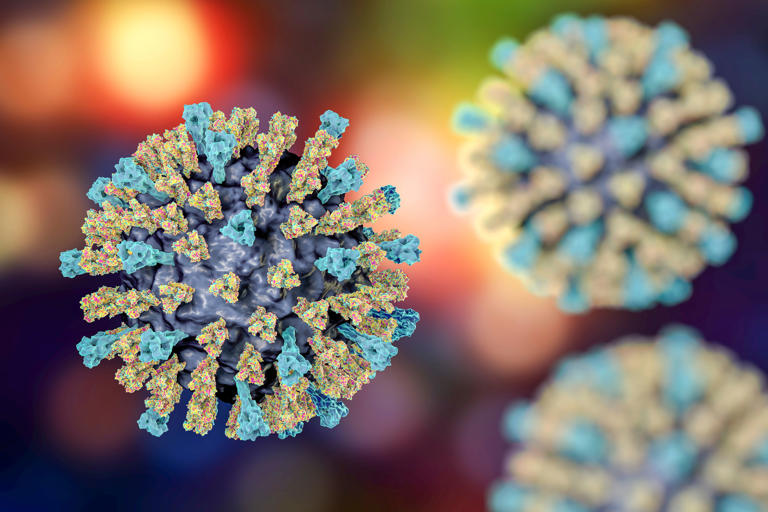 Allegheny County Health Department monitoring spread of measles across ...