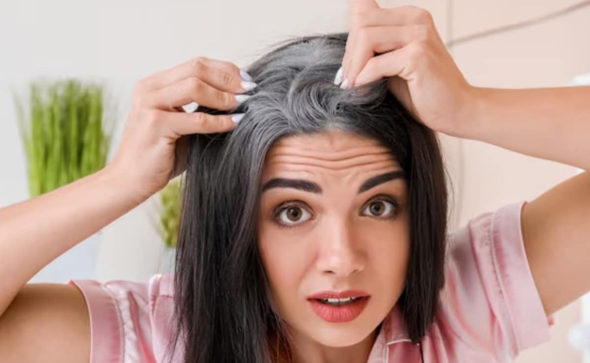 Grey hair in 20s? Possible causes and solutions explained