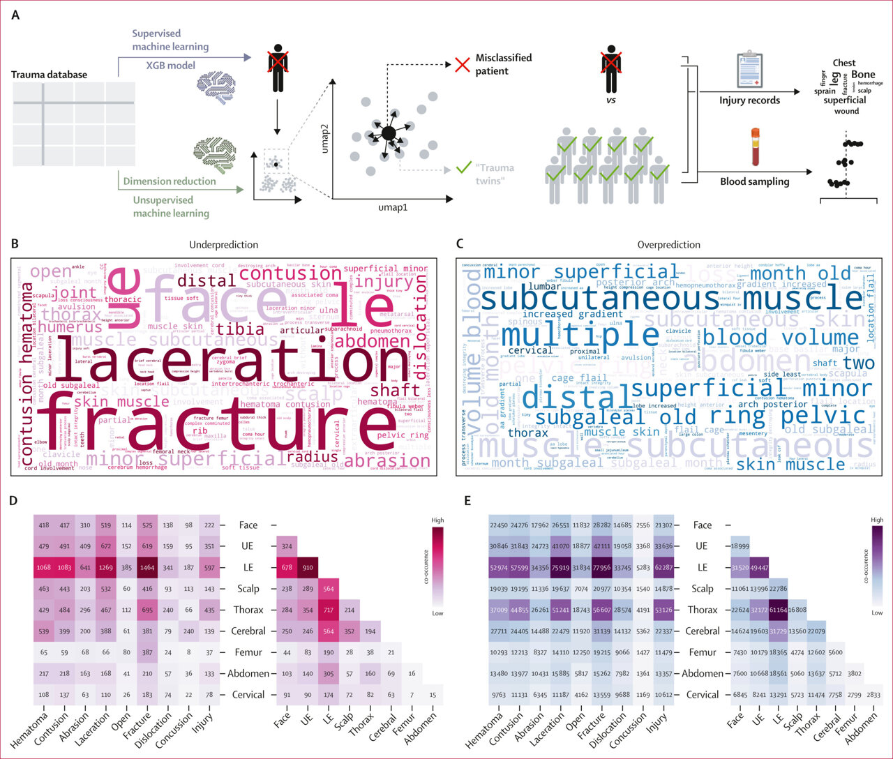 AI tool can predict which trauma patients need blood transfusions ...