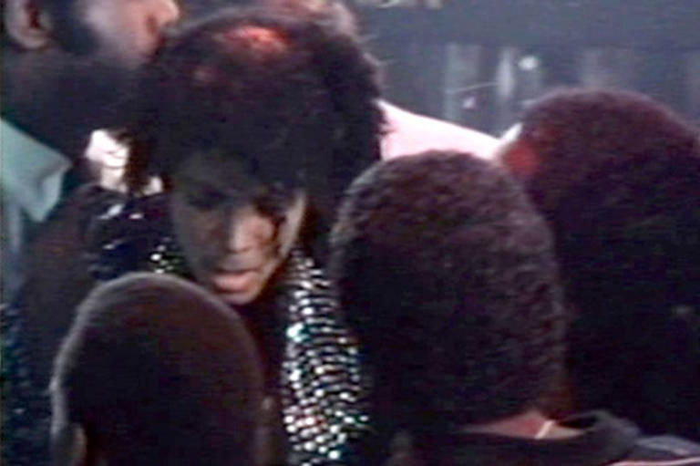 Michael Jackson's autopsy revealed the hidden reality behind the pop ...