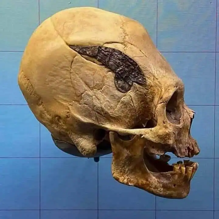 10 things to know about Peru’s Paracas skulls and their red hair