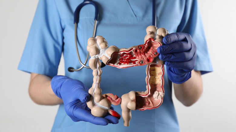 Warning signs from your appendix that you shouldn't ignore