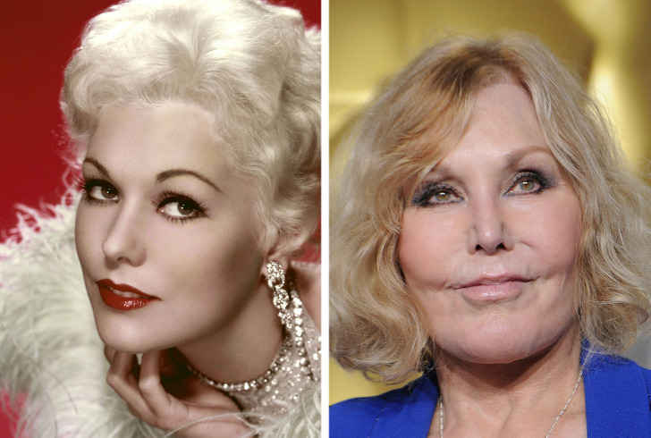 10+ famous people whose appearances changed beyond recognition
