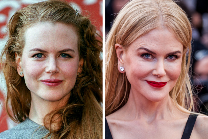 10+ famous people whose appearances changed beyond recognition