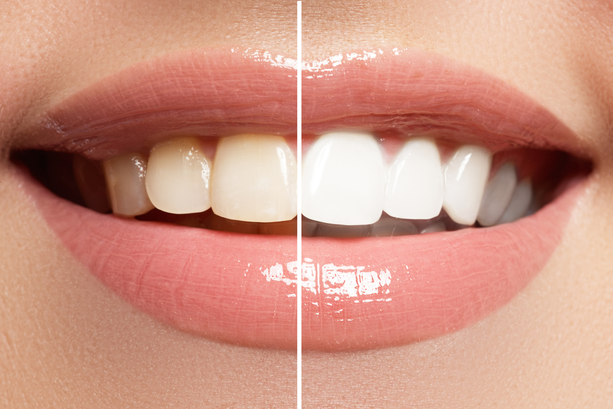 20 tips to keep your teeth pearly white