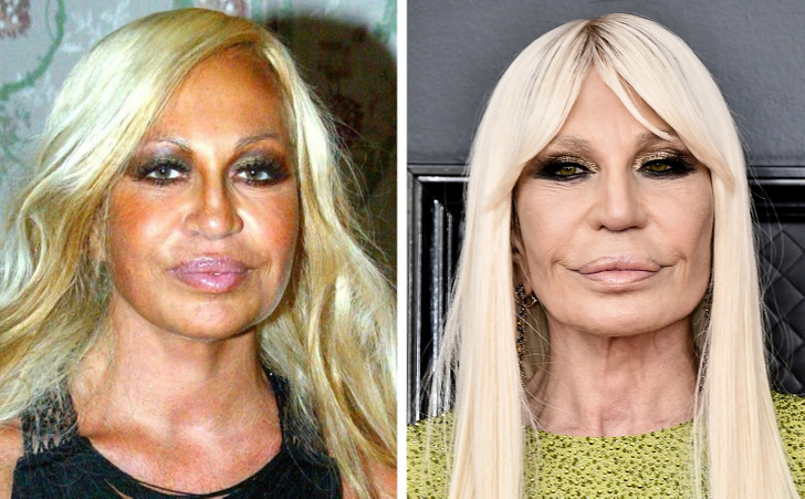 10+ famous people whose appearances changed beyond recognition