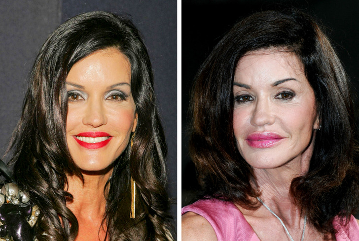 10+ famous people whose appearances changed beyond recognition