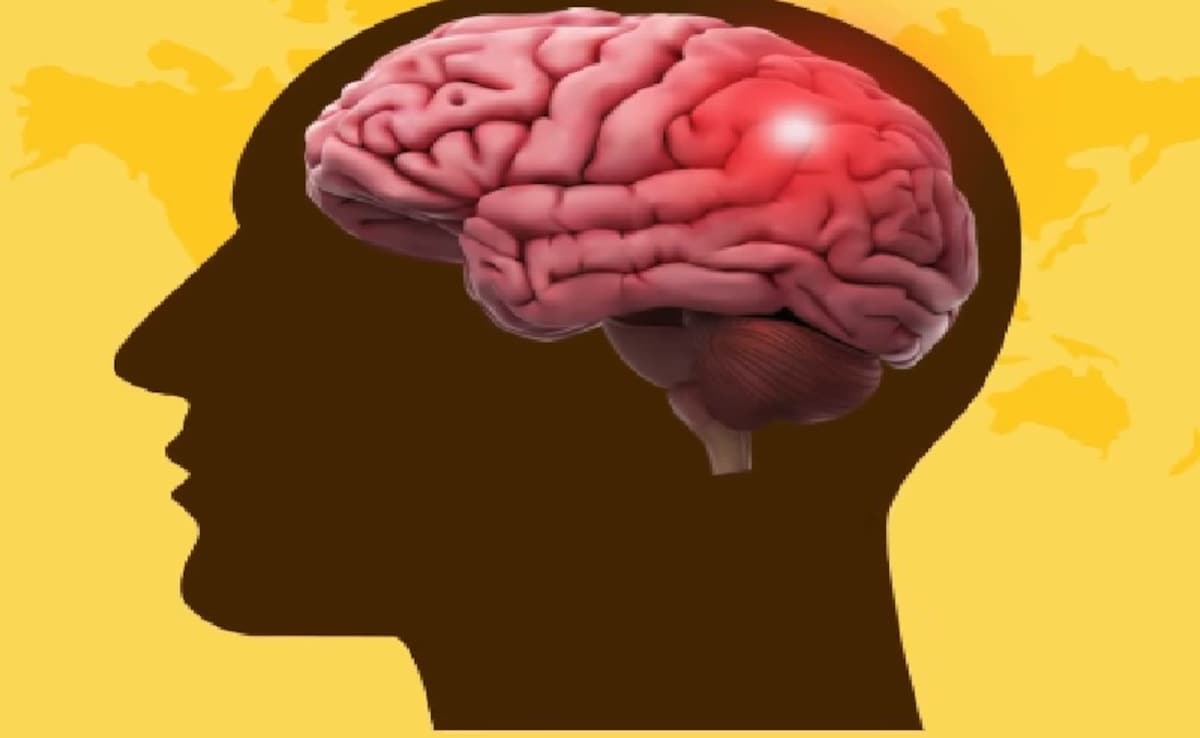 Mini-stroke symptoms: 7 signs of transient ischemic attack that you ...