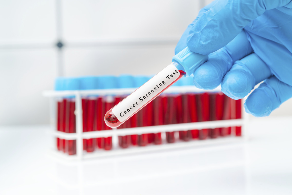 Oncologists want people to take this one common cancer risk factor ...