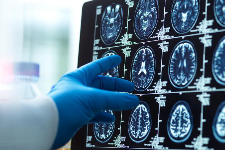 Problem in the kitchen could be common 'early' sign of dementia - what ...
